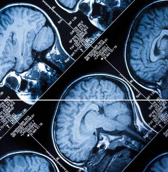 Your Kid's Mind on Concussions | Seattle Area Family Fun Calendar ...